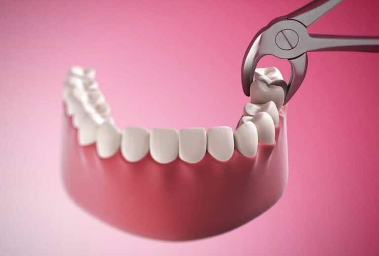 Pivot dentar: caracteristici, tipuri, rol, indicatii, pret | Dental Premier
