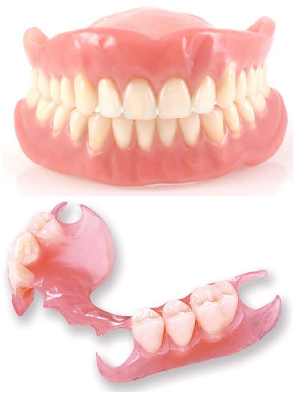 Proteza dentara elastica | Dental Premier
